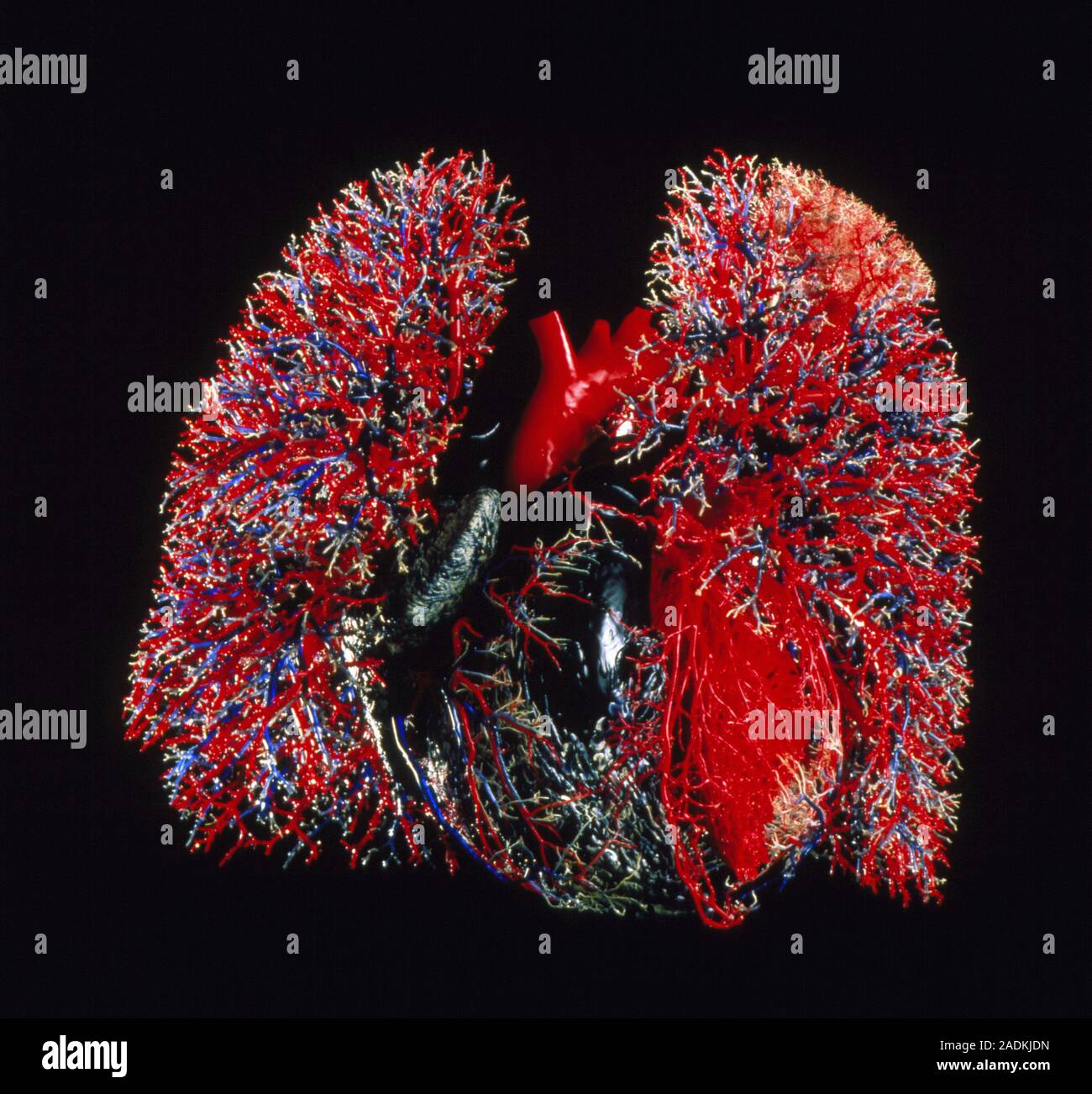 Resin cast of the blood vessels of the human heart and lung, viewed ...