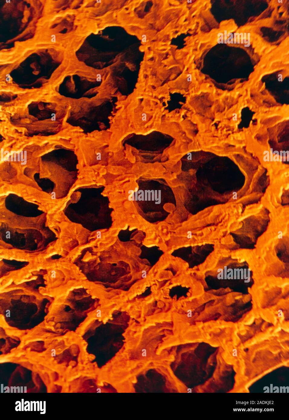 False-colour scanning electron micrograph (SEM) of a section of the ...