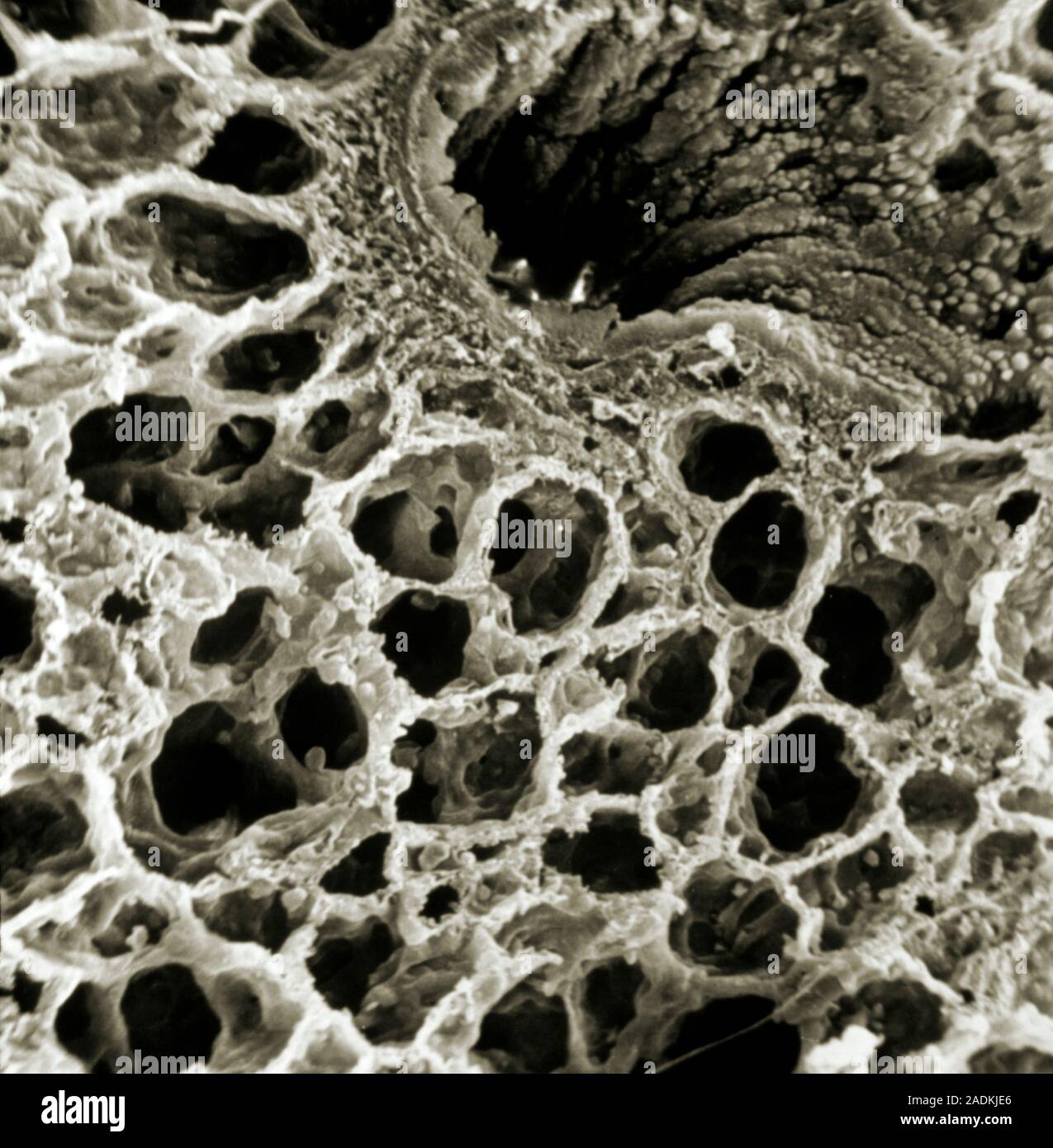 Scanning electron micrograph (SEM) of a section of human lung, showing ...