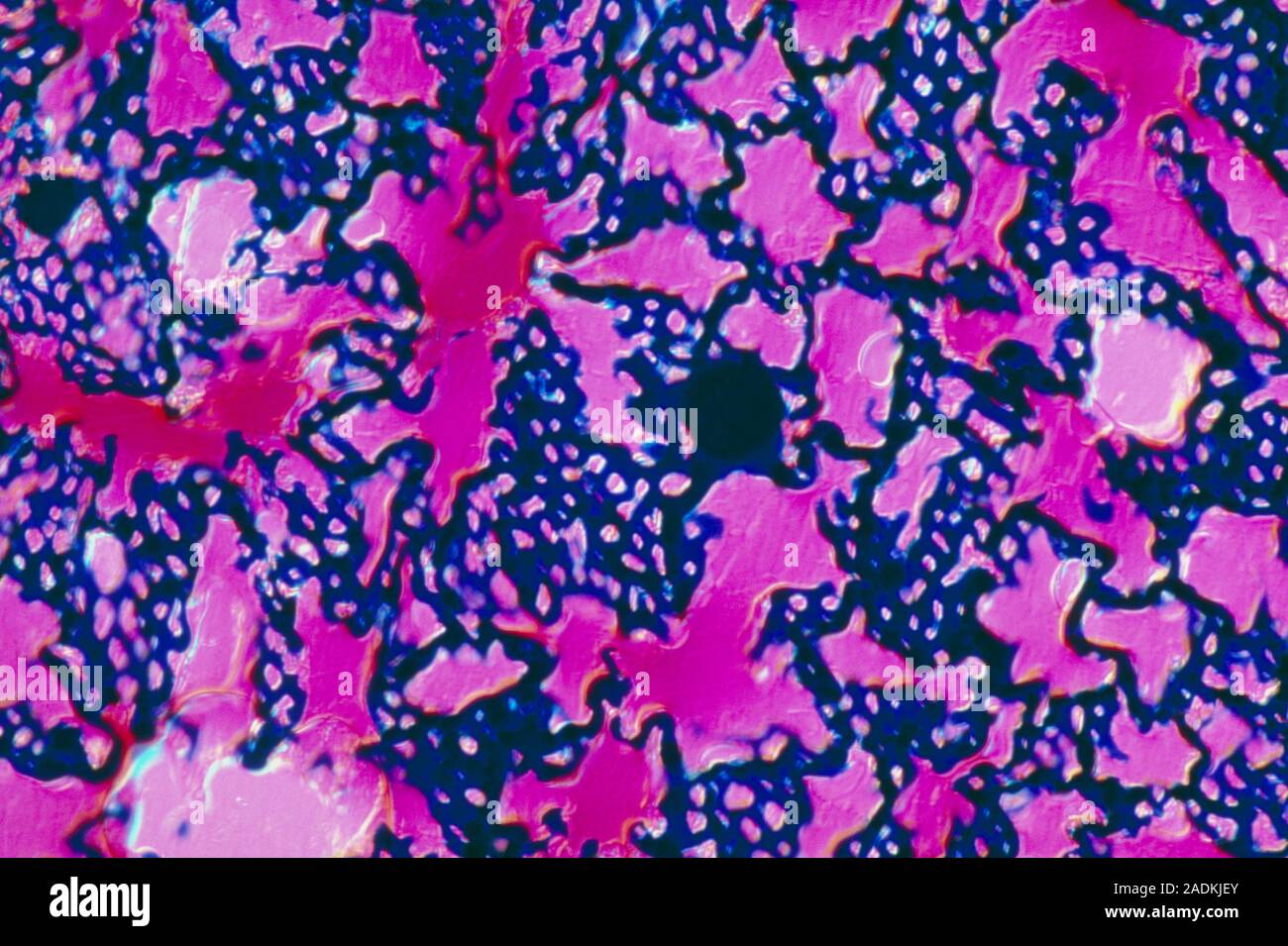 Light micrograph of a section of normal lung tissue showing the smooth ...