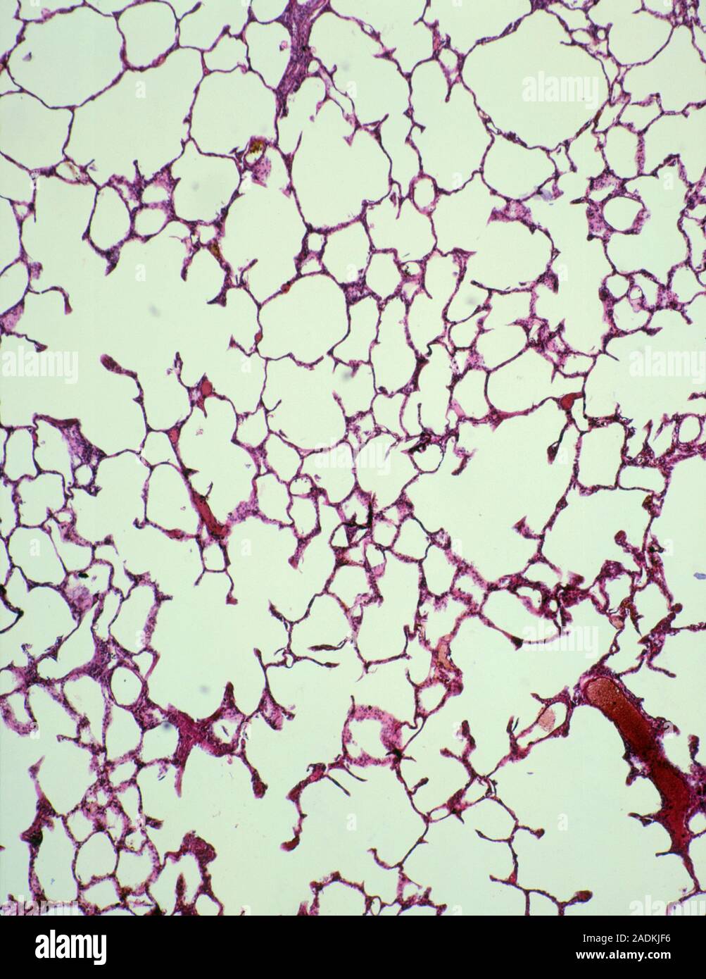 Light micrograph of a secion of lung tissue showing numerous alveoli ...