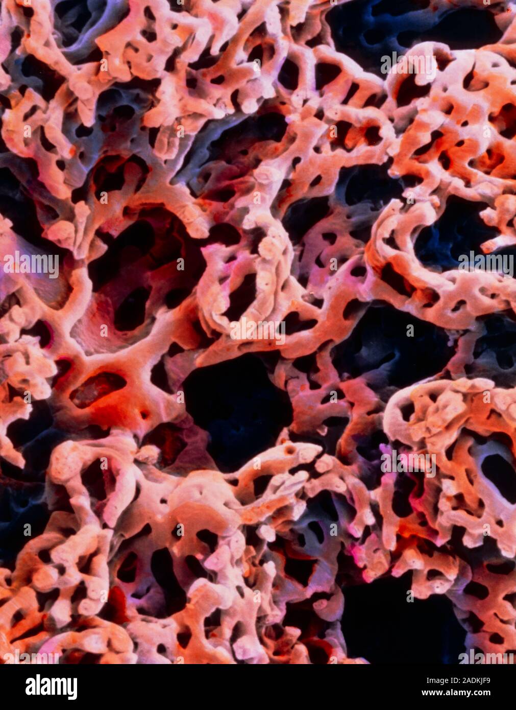 Microcirculation of lung. False-colour scanning electron micrograph ...