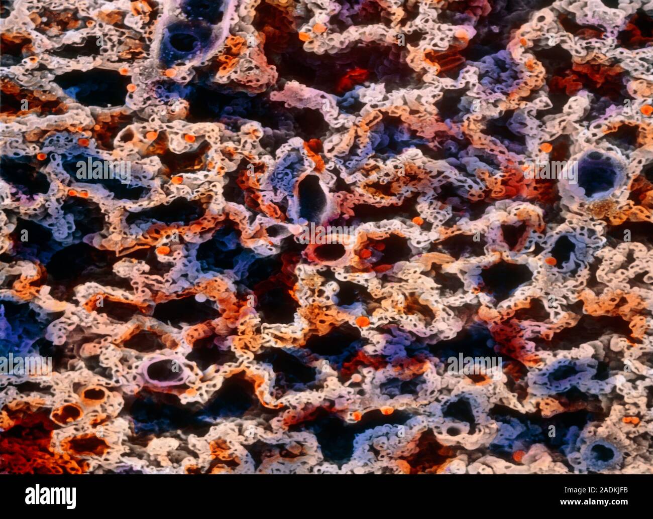 Lung tissue. False-colour scanning electron micrograph (SEM) of a ...