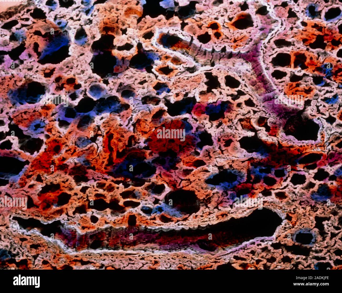 Lung tissue. False-colour scanning electron micrograph of a section of ...