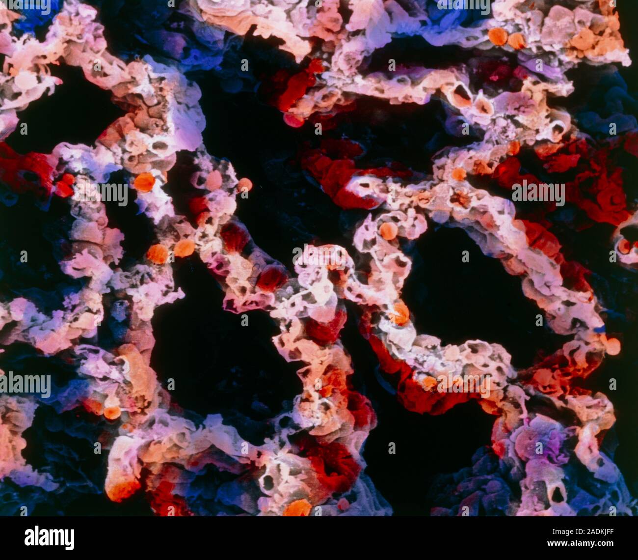 Lung tissue. False-colour scanning electron micrograph (SEM) of a ...