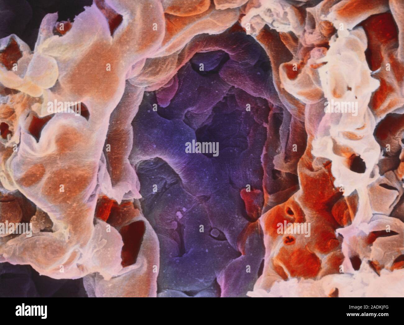 Alveolus. False-colour scanning electron micrograph (SEM) of an ...