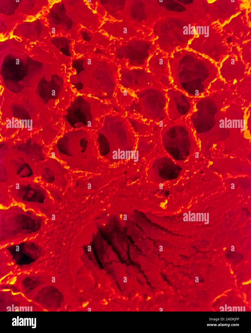 False-colour scanning electron micrograph (SEM) of a section of human ...