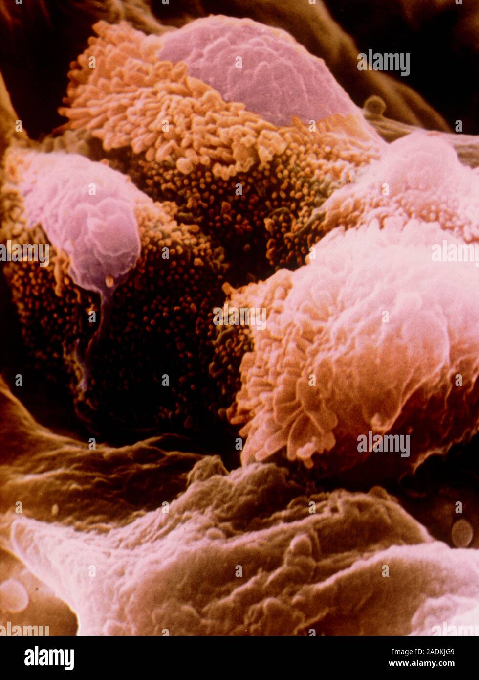 Lung alveolar cells. Coloured Scanning Electron Micrograph (SEM) of ...