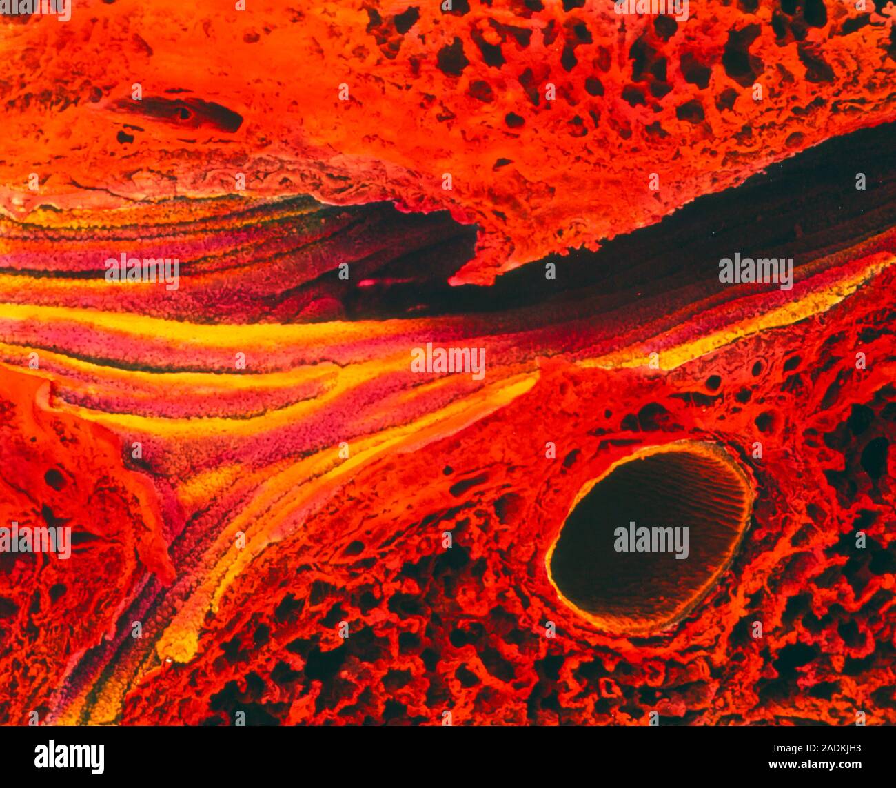 Lung alveoli & bronchus. Coloured Scanning Elec- tron Micrograph (SEM ...