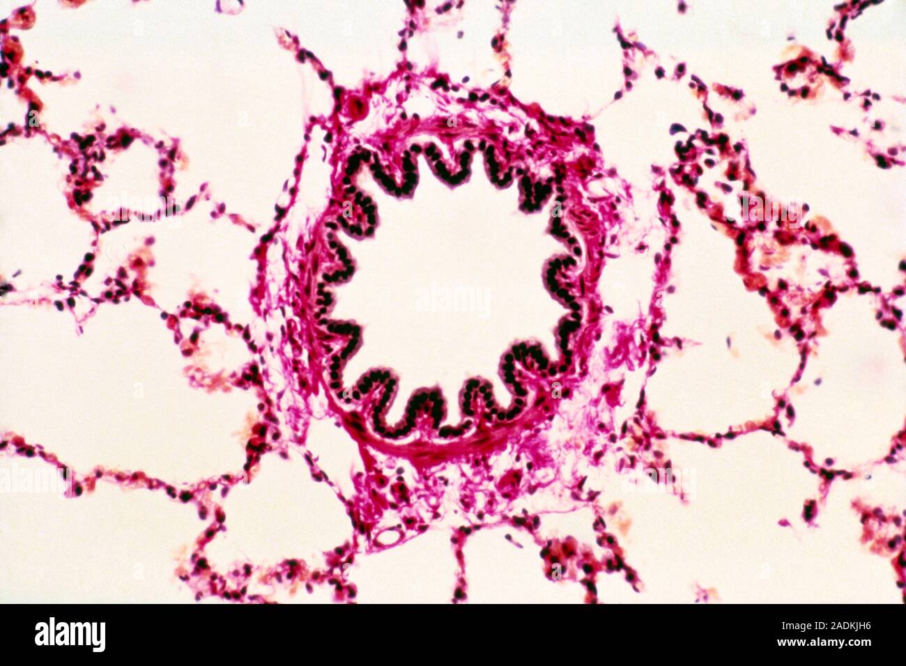 Bronchiole of lung. Light micrograph of a cross section through a ...