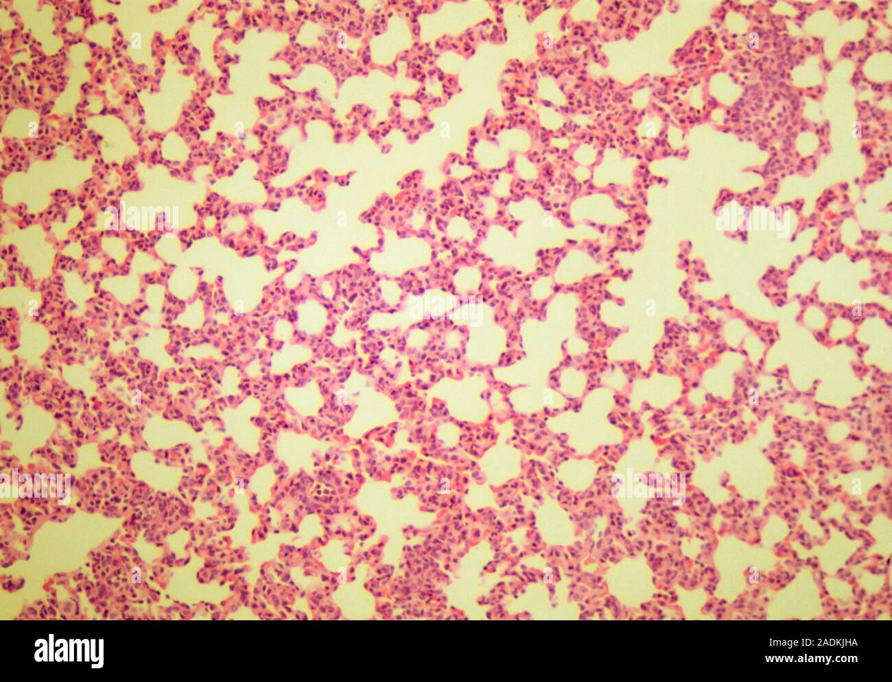 Lung alveoli. Light micrograph of a cross section through lung tissue ...