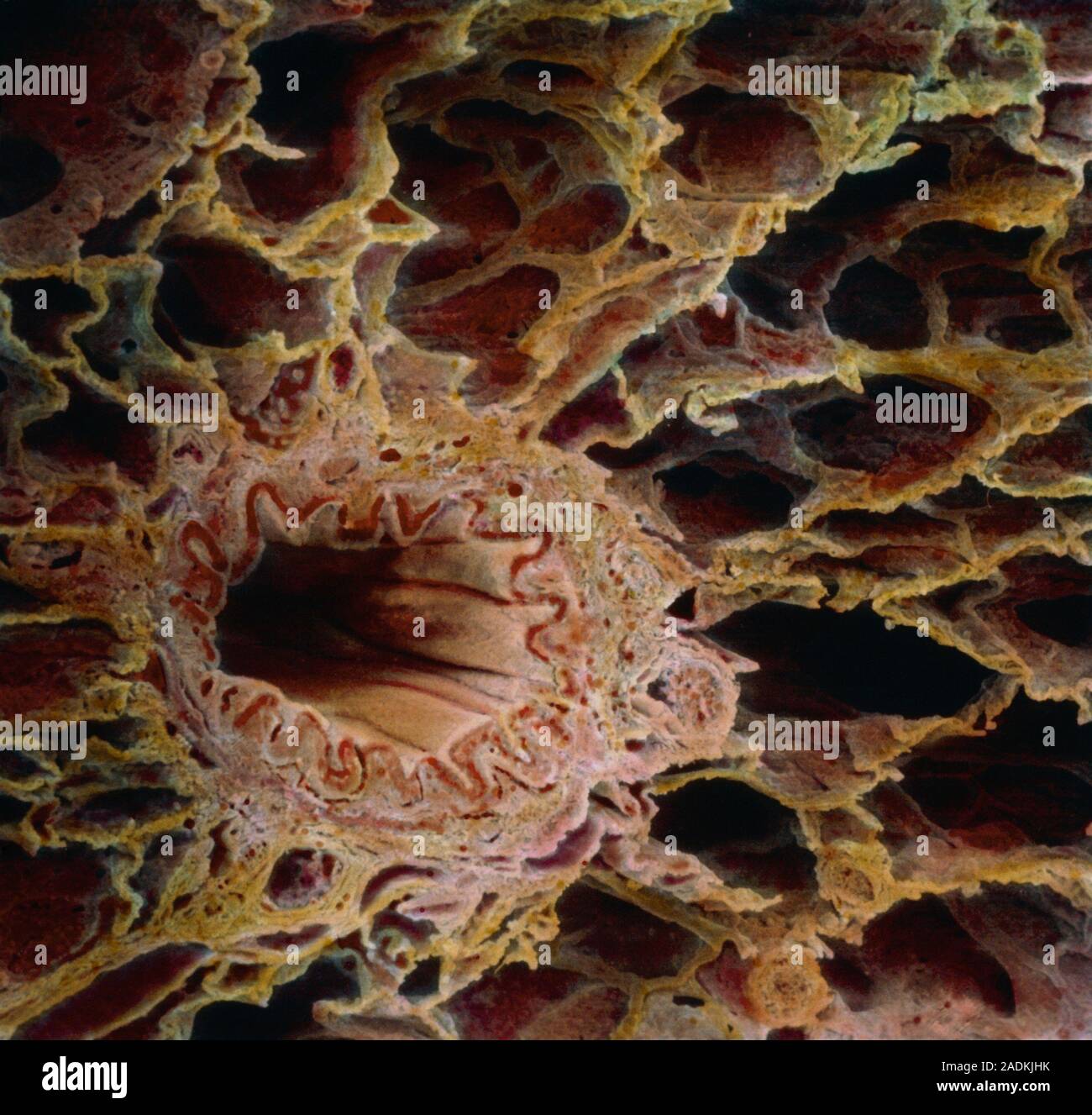 Lung alveoli. Coloured scanning electron microgr- aph (SEM) of healthy ...
