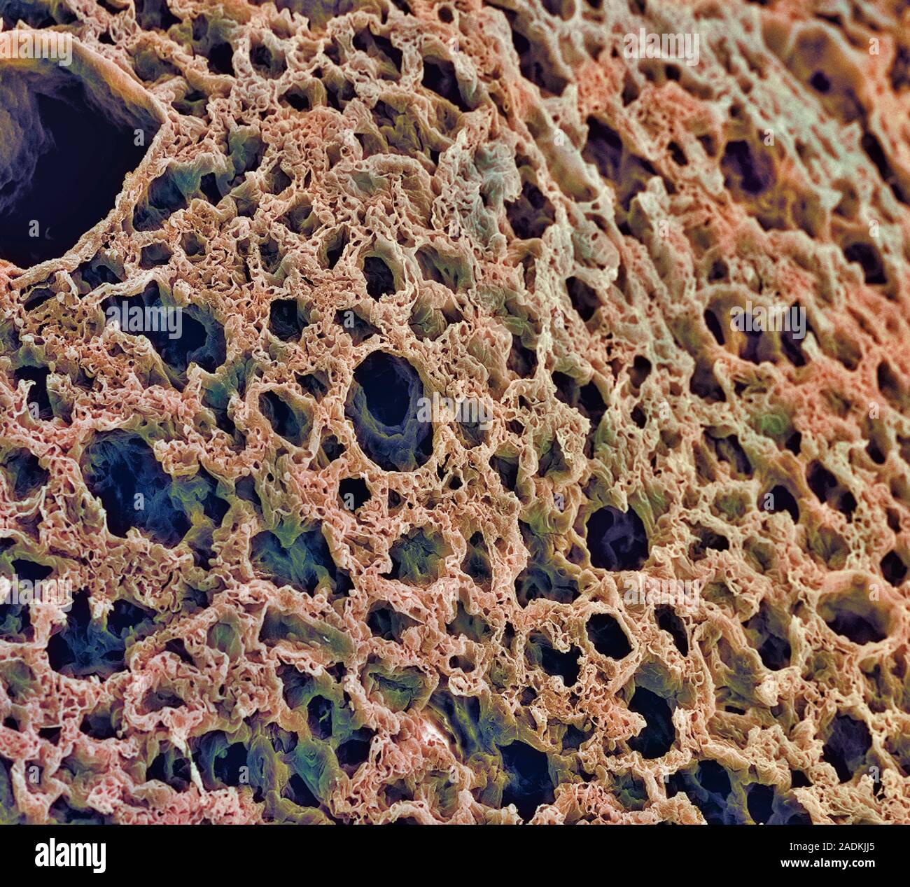 Lung alveoli. Coloured scanning electron micrograph (SEM) of healthy ...