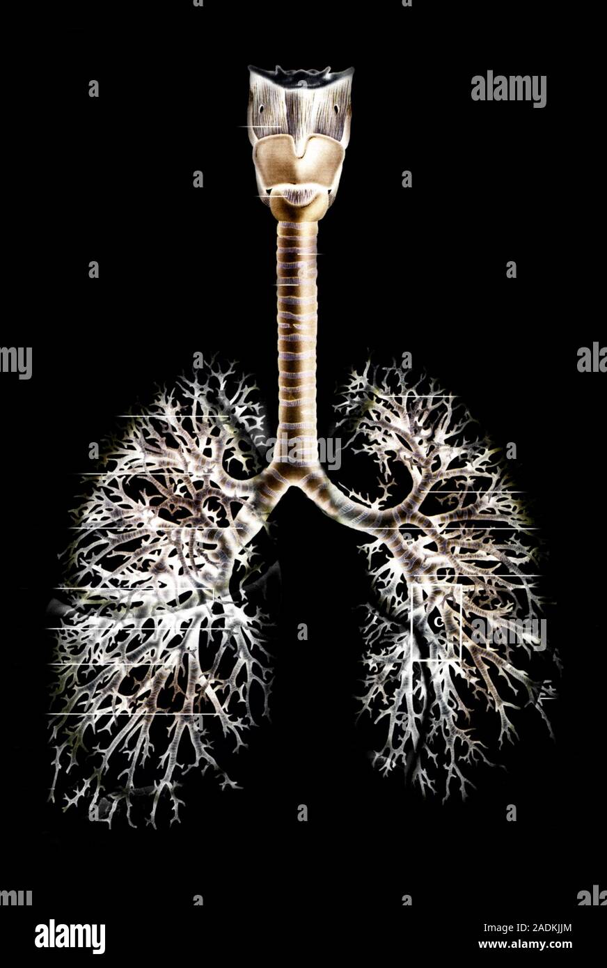 Lungs. Computer artwork of the air passages of a pair of normal human ...