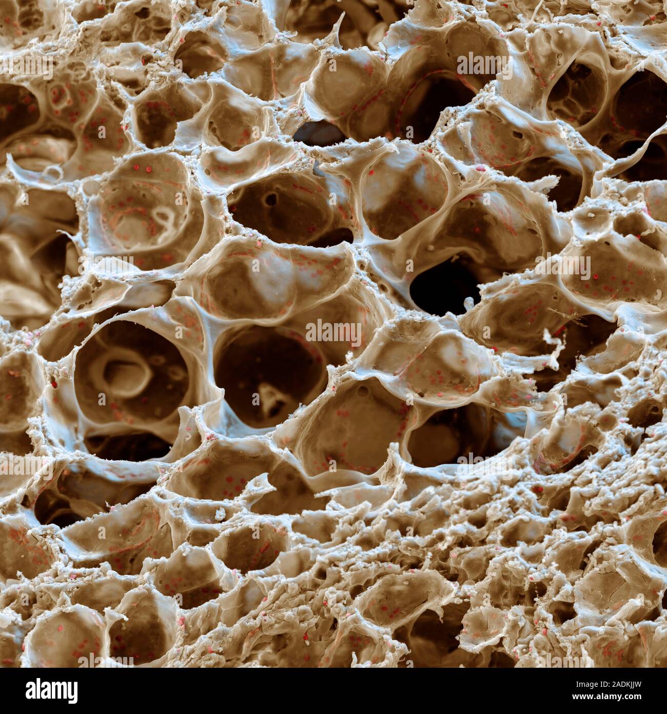 Lung alveoli. Coloured scanning electron micrograph (SEM) of alveoli in ...