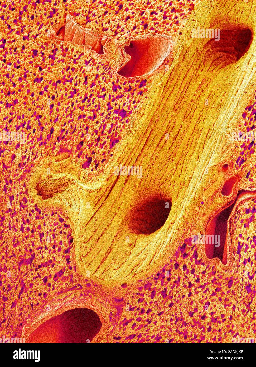 Lung bronchiole and alveoli. Coloured scanning electron micrograph (SEM ...