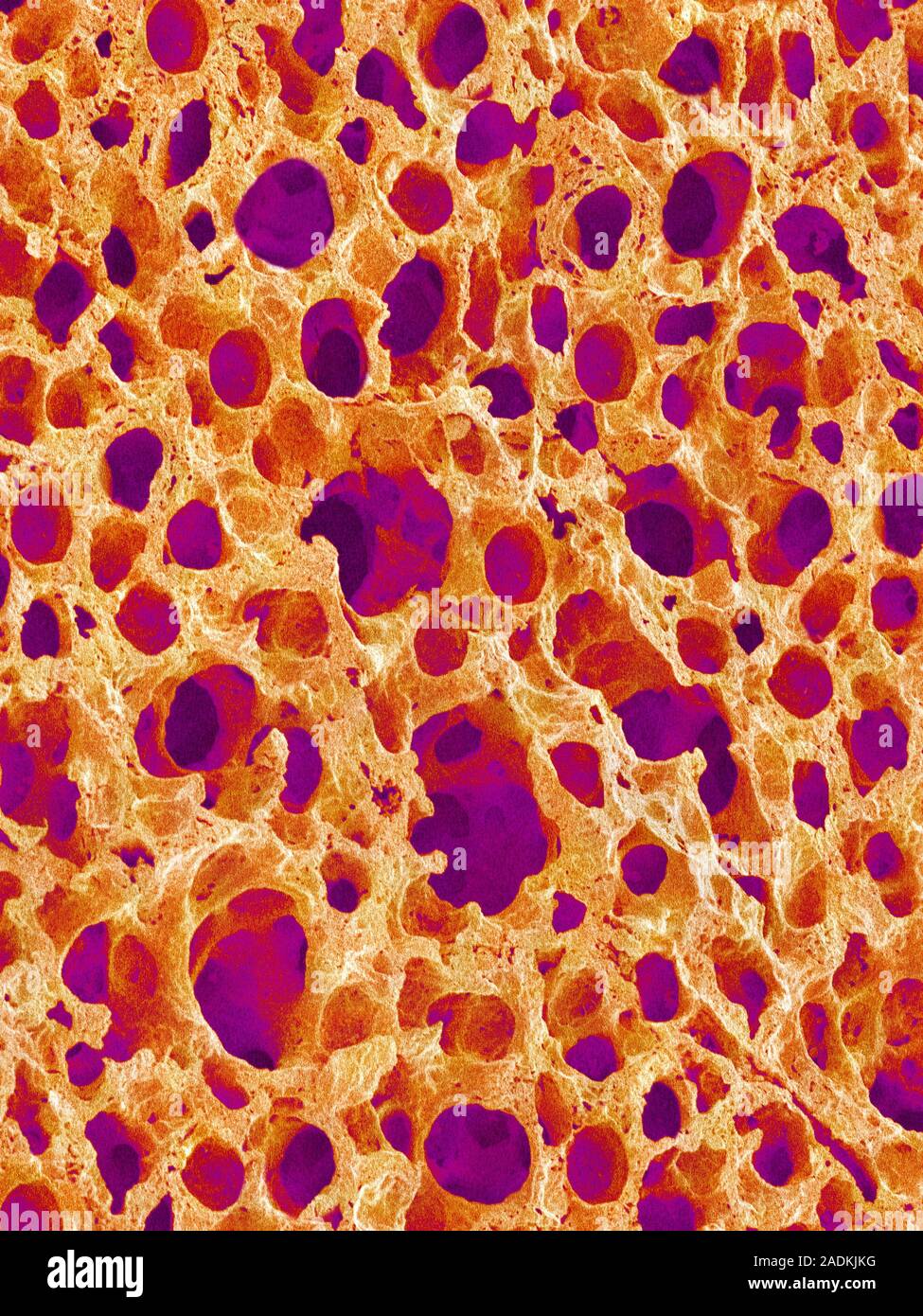 Lung alveoli. Coloured scanning electron micrograph (SEM) of alveoli ...