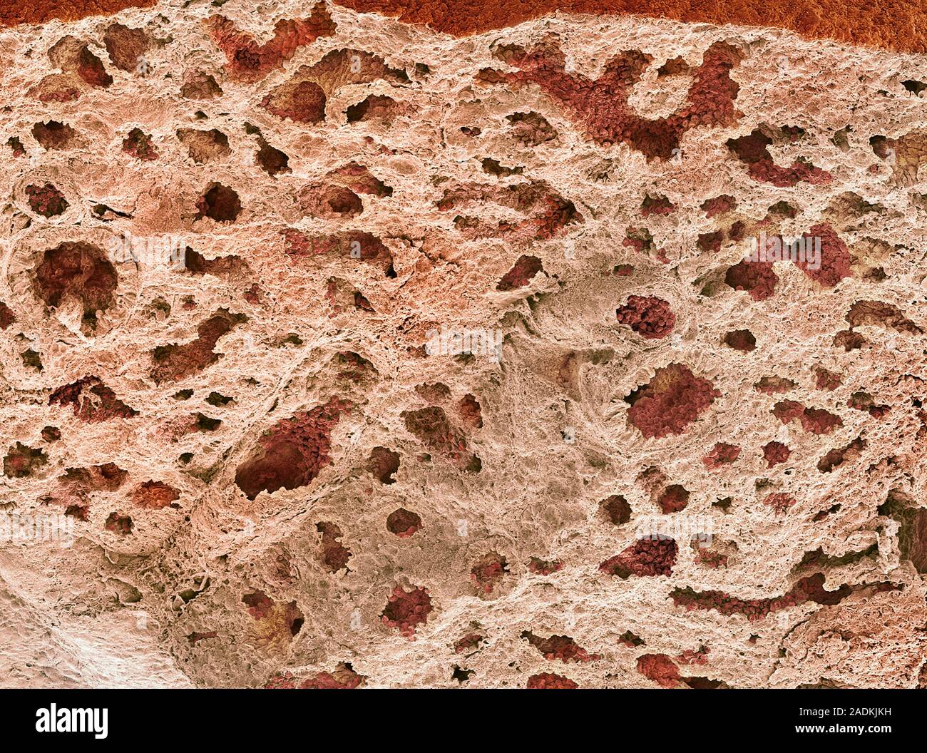 Lung alveoli. Coloured scanning electron micrograph (SEM) of alveoli ...