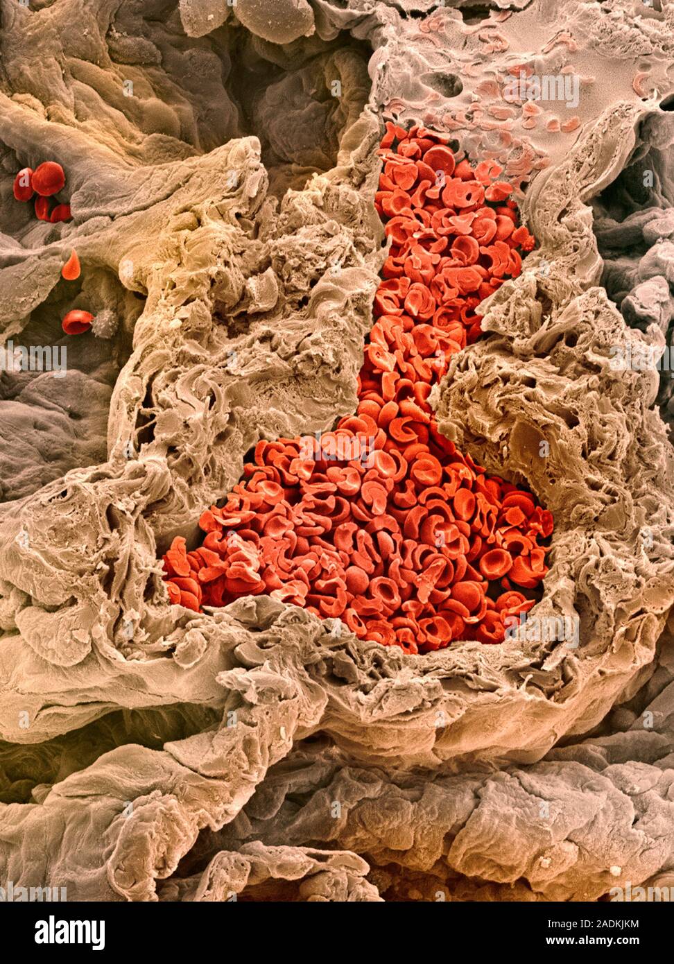 Lung blood vessel. Coloured scanning electron micrograph (SEM) of blood ...