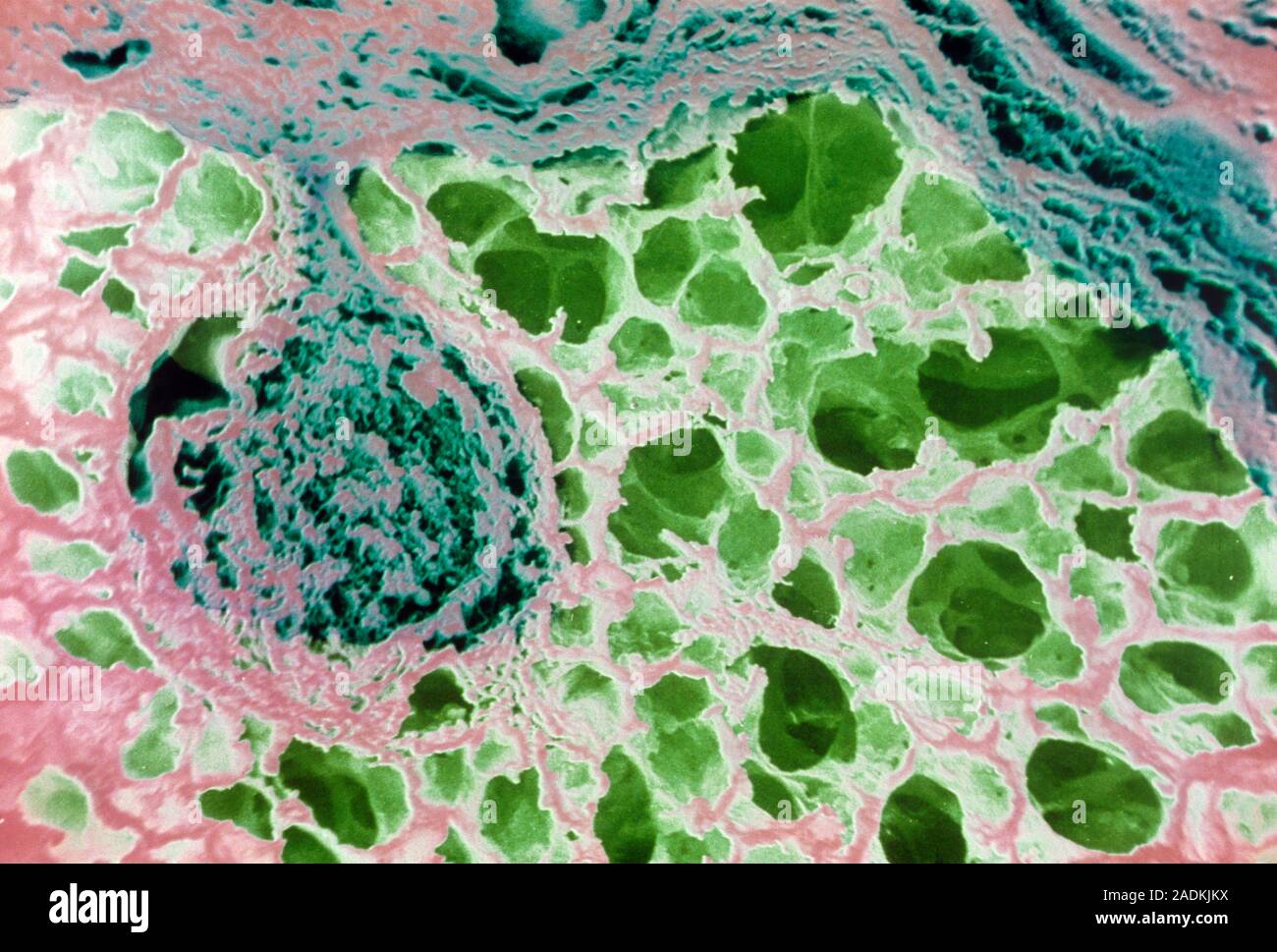 Lung alveoli and an arteriole (left), coloured scanning electron ...