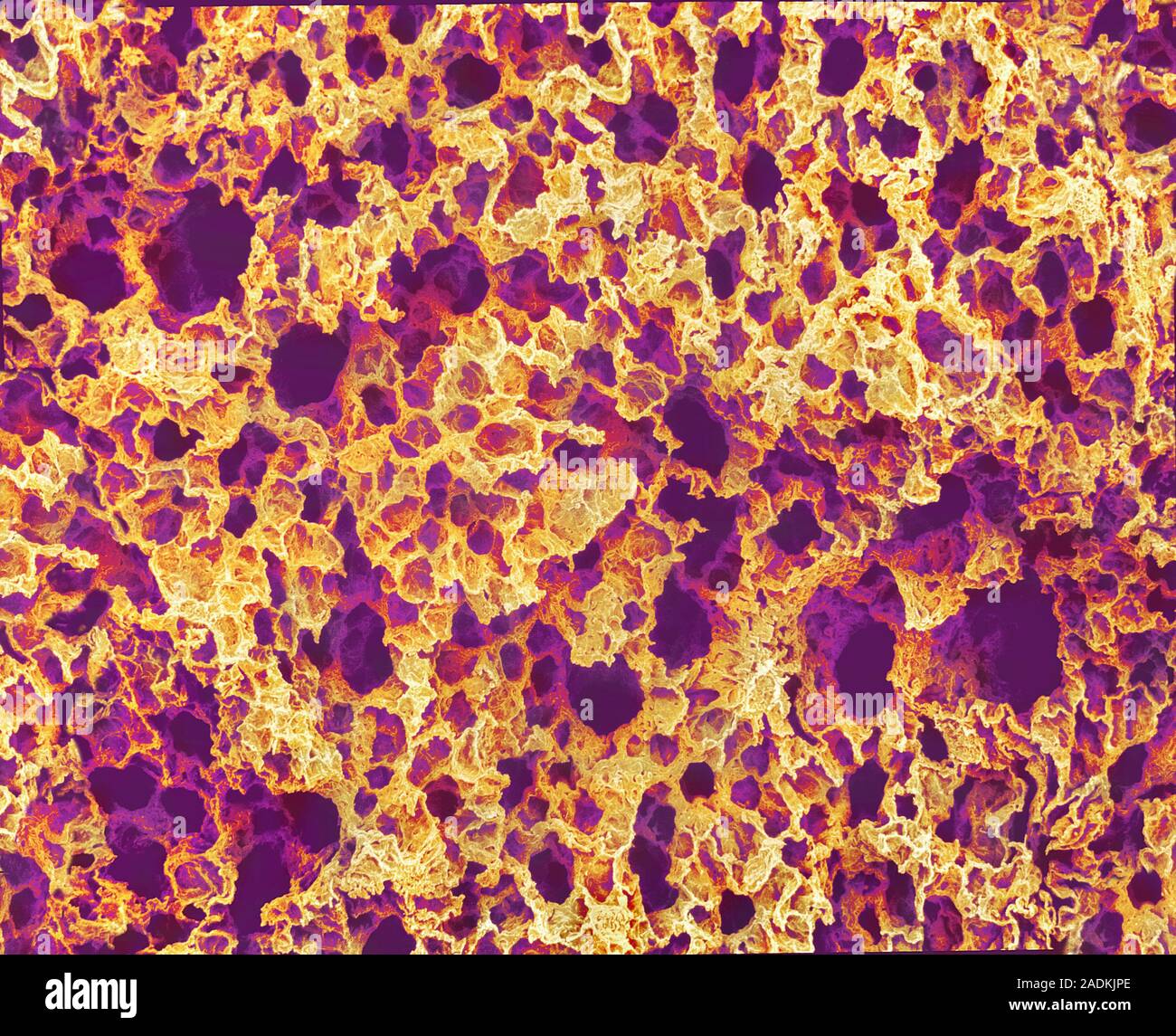 Rat lung alveoli. Coloured scanning electron micrograph (SEM) of a ...