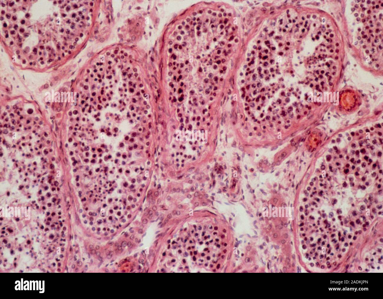Light Micrograph Of Normal Human Testis Sperm Is Produced In A System