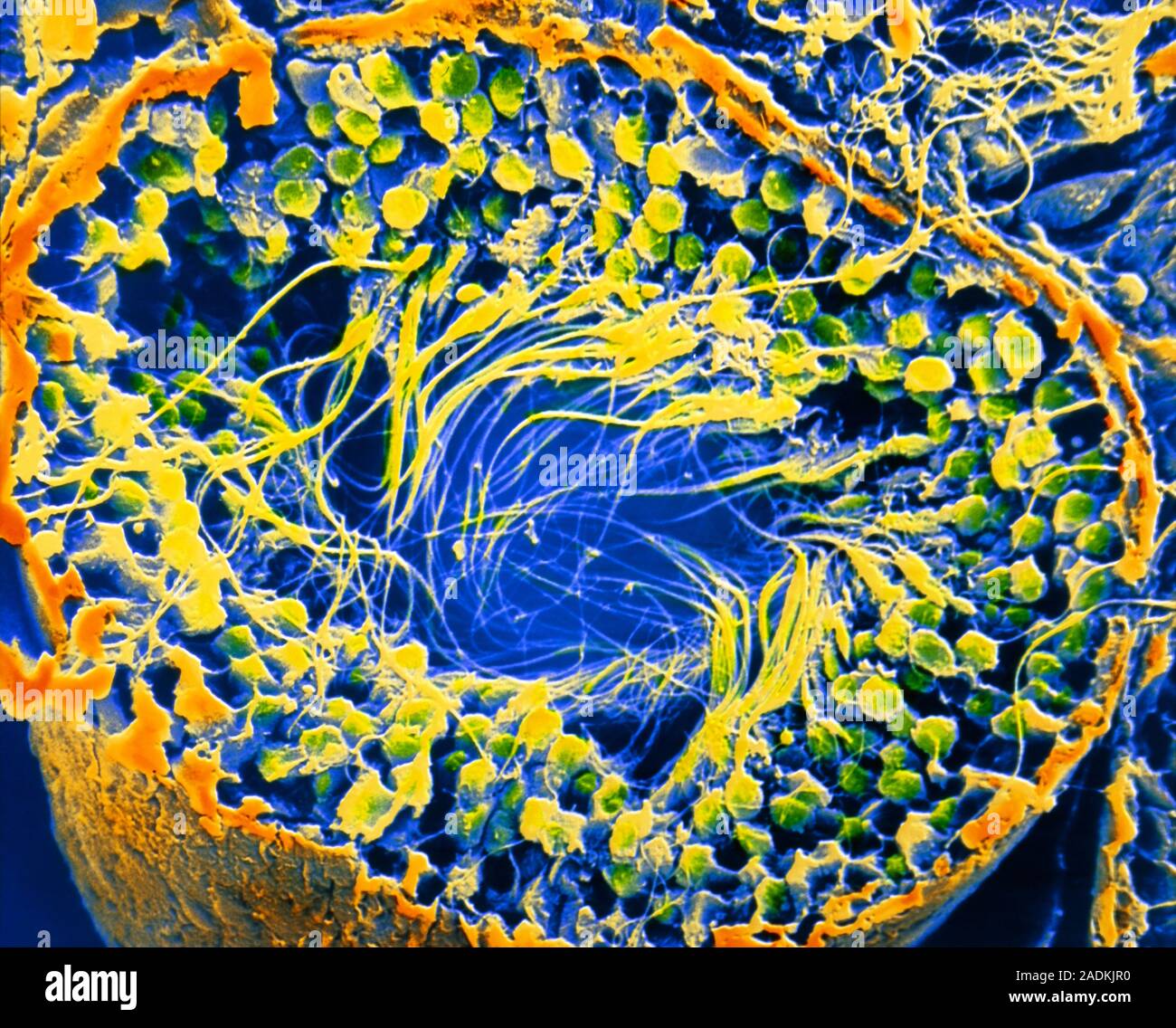 False Colour Scanning Electron Micrograph Of A Section Through A Human