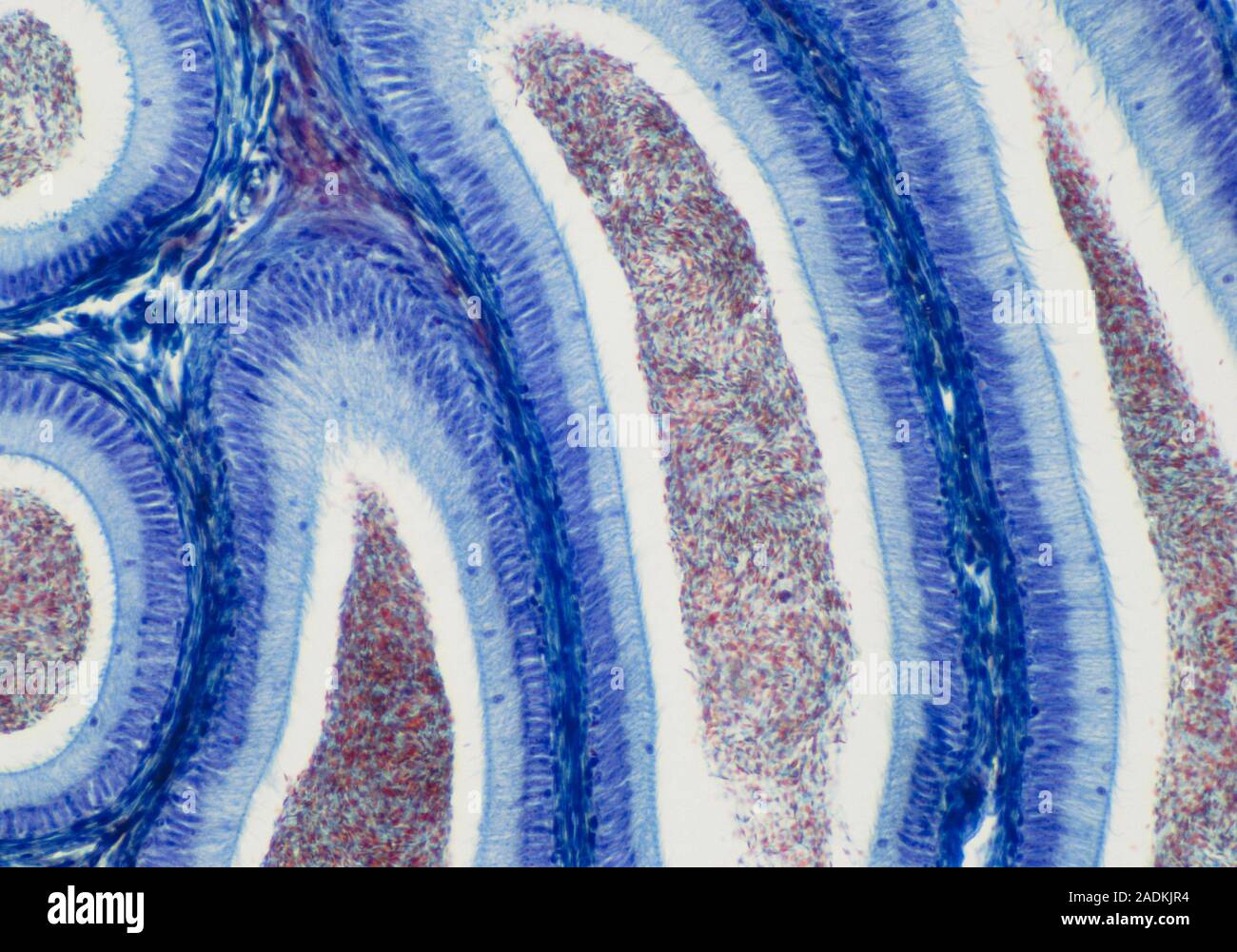 Light micrograph of normal human epididymis. The bulk of the epididymis ...
