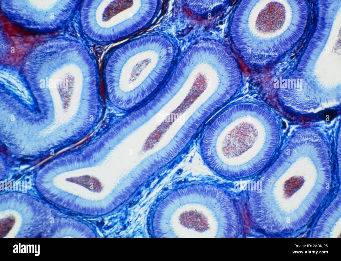 Light micrograph of a normal human epididymis, a tube connecting the ...