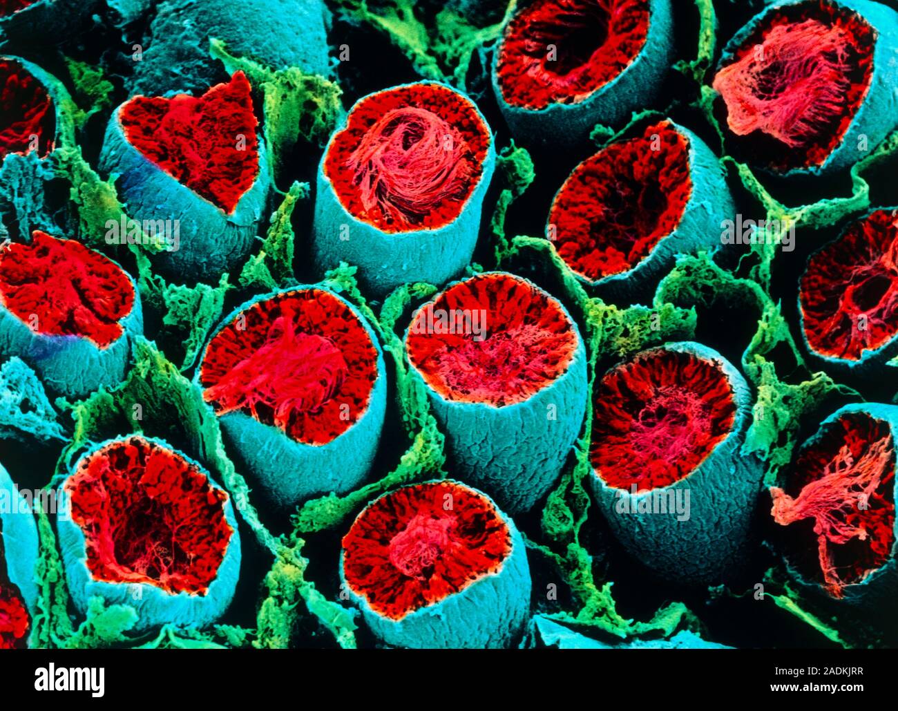 Seminiferous Tubules Coloured Scanning Electron Micrograph Sem Of