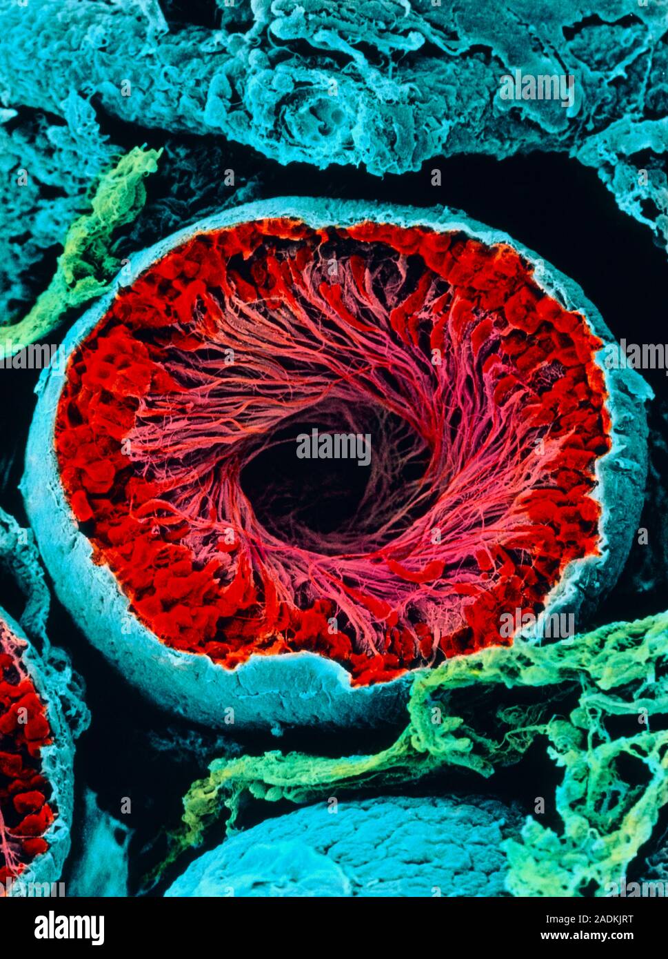 Seminiferous Tubule Coloured Scanning Electron Micrograph Sem Of A