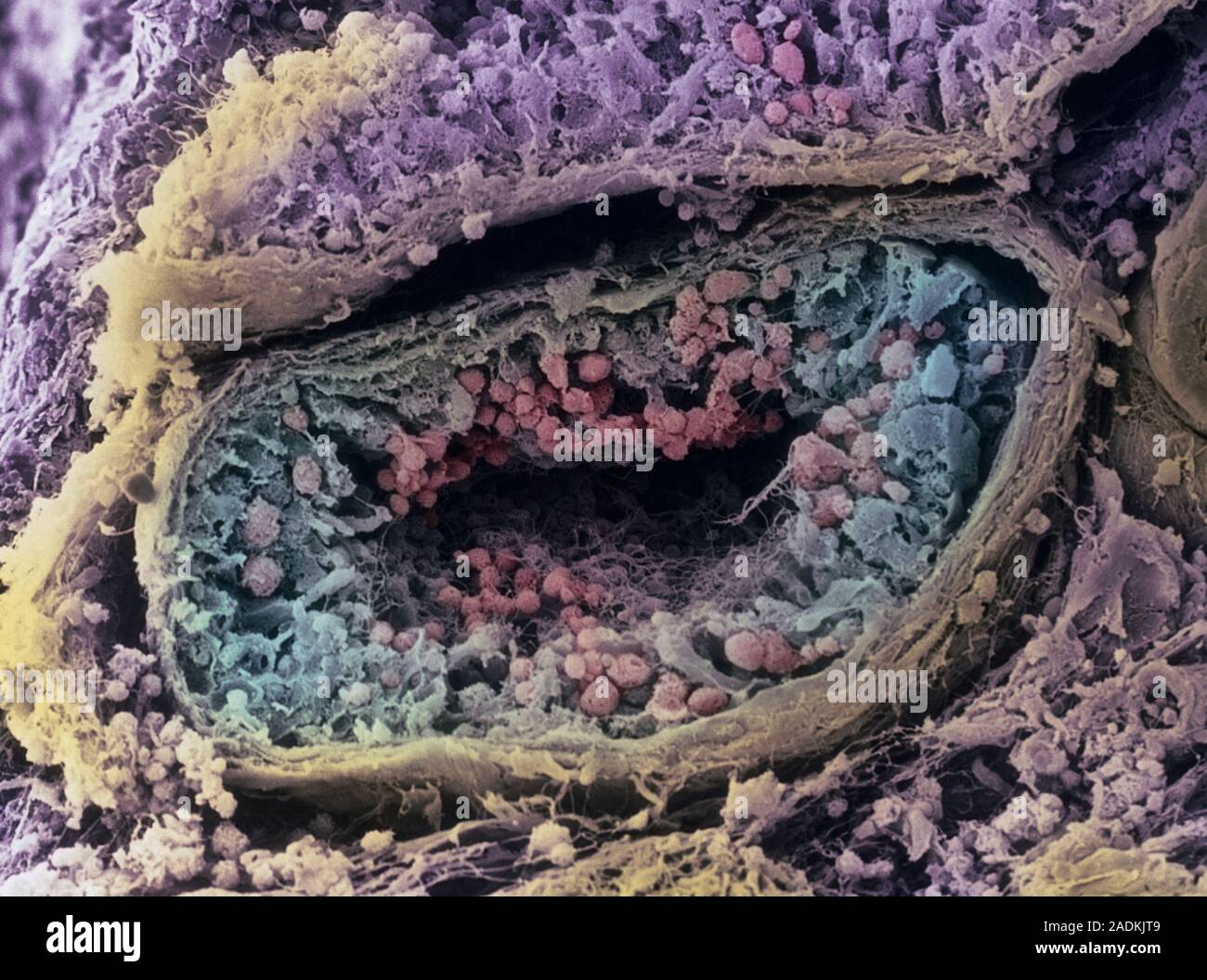 Seminiferous Tubule Coloured Scanning Electron Micrograph Sem Of A