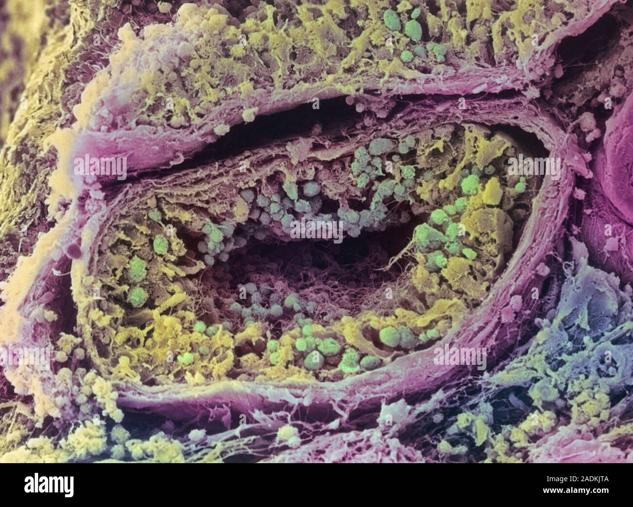 Seminiferous Tubule Coloured Scanning Electron Micrograph Sem Of A