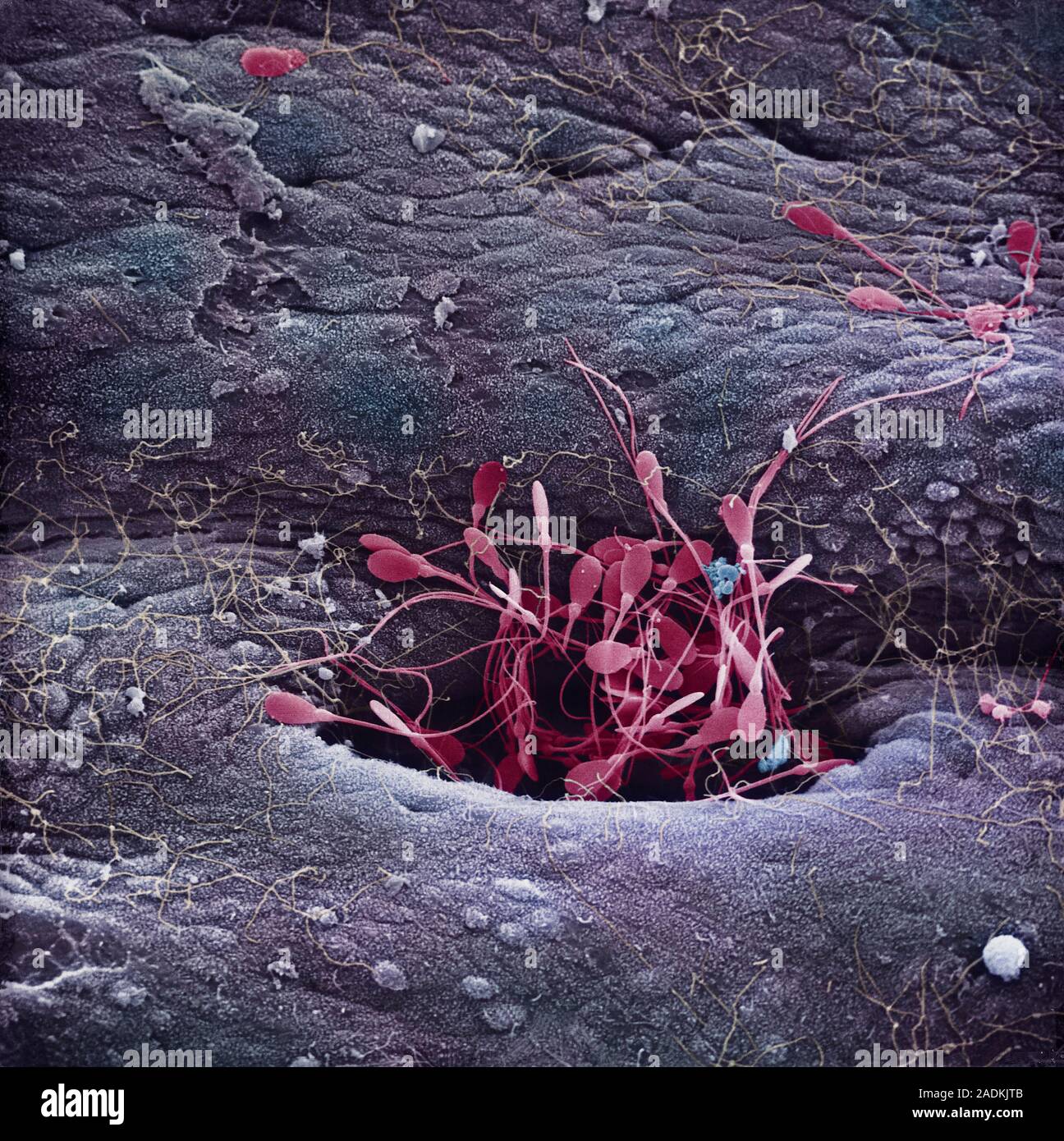 Sperm production. Coloured scanning electron micrograph (SEM) of ... Sperm production. Coloured scanning electron micrograph (SEM) of ...