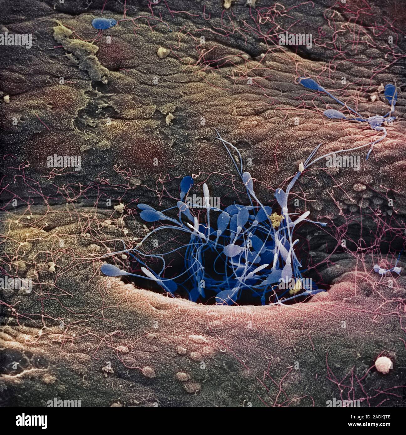 Sperm production. Coloured scanning electron micrograph (SEM) of ...