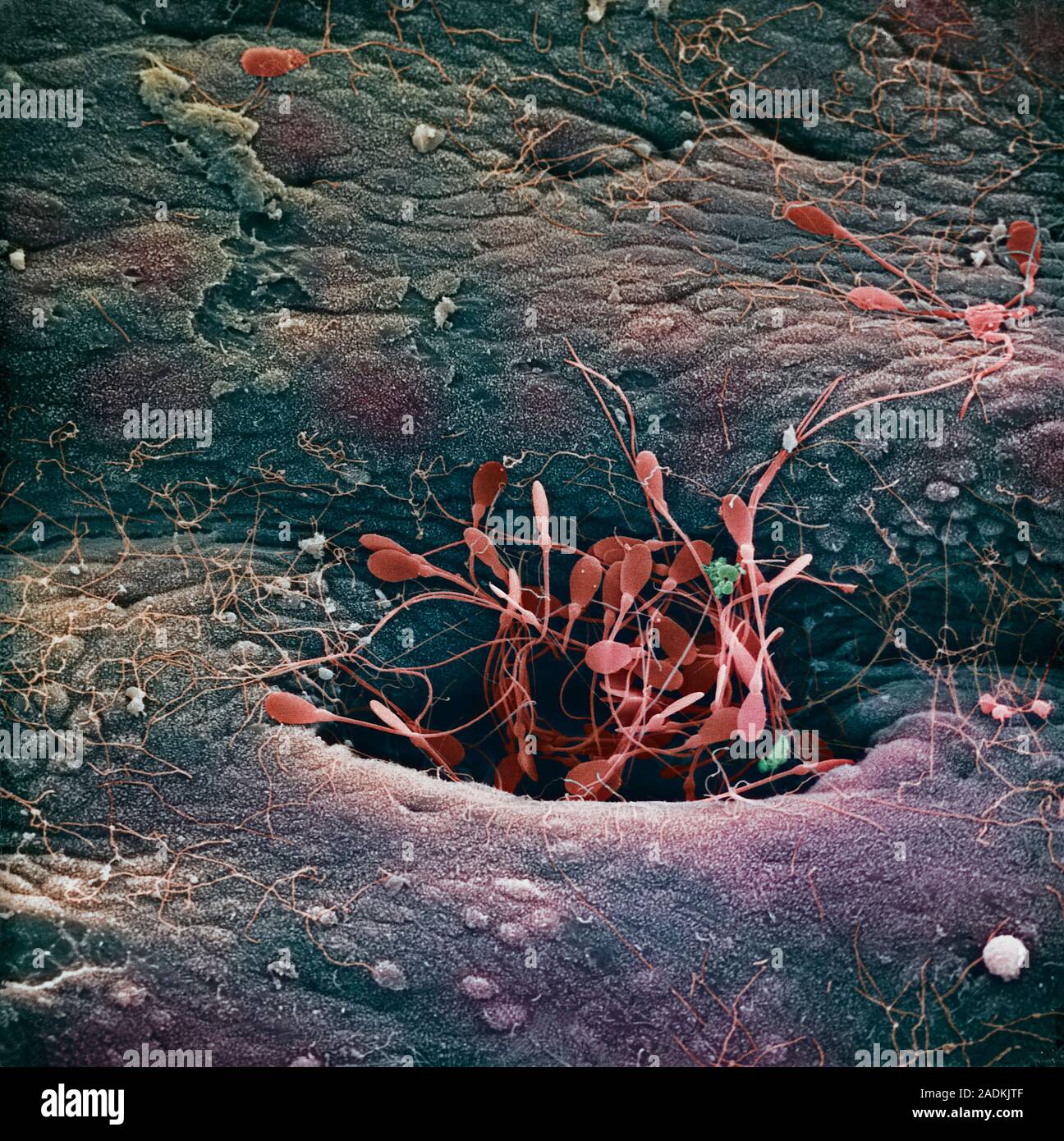 Sperm Production Coloured Scanning Electron Micrograph Sem Of
