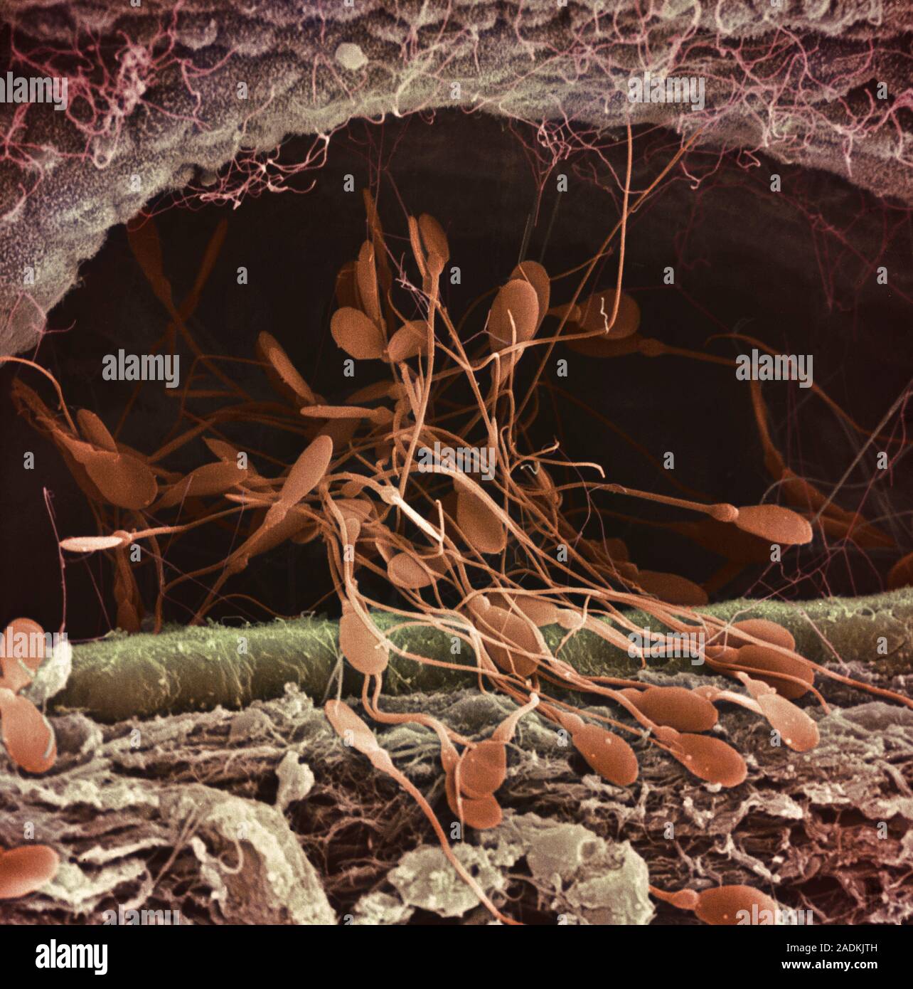 Sperm Production Coloured Scanning Electron Micrograph Sem Of
