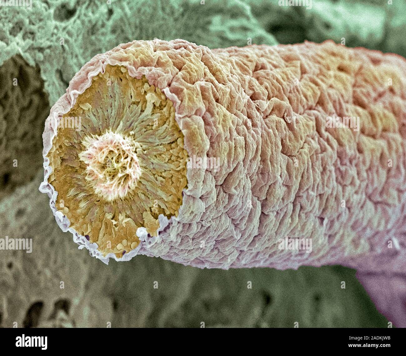 Sperm production site. Coloured scanning electron micrograph (SEM) of a ... Sperm production site. Coloured scanning electron micrograph (SEM) of a ...