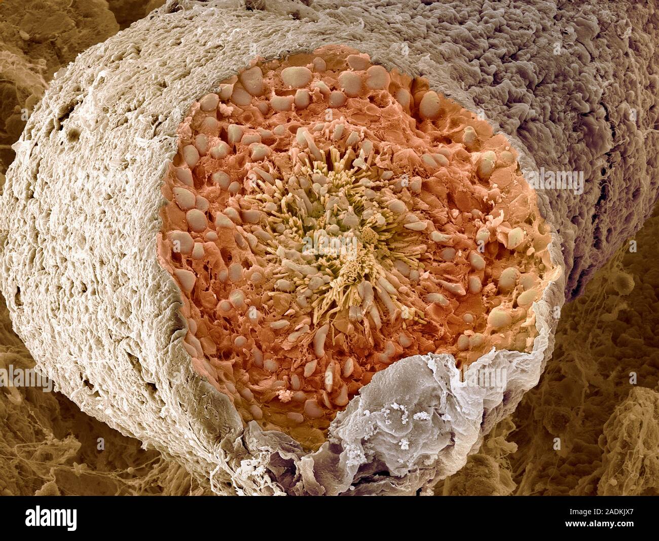 Sperm Production Site Coloured Scanning Electron Micrograph Sem