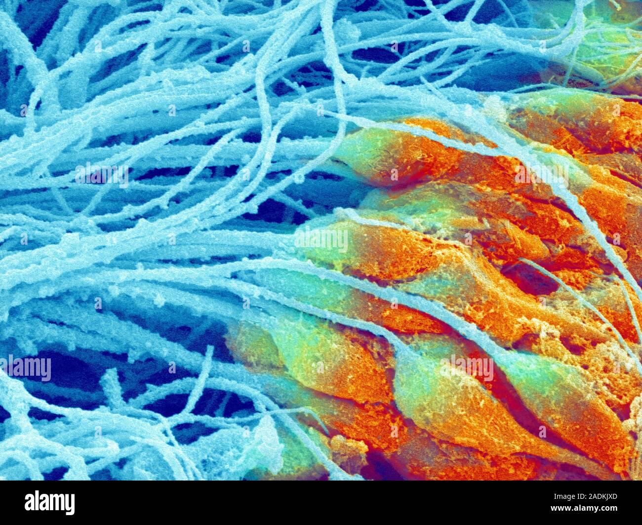 Sperm Production Coloured Scanning Electron Micrograph Sem Of Sperm