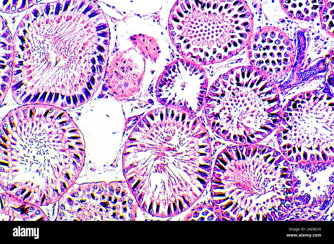Earthworm Lumbricus Cross Section Earthworms Biology