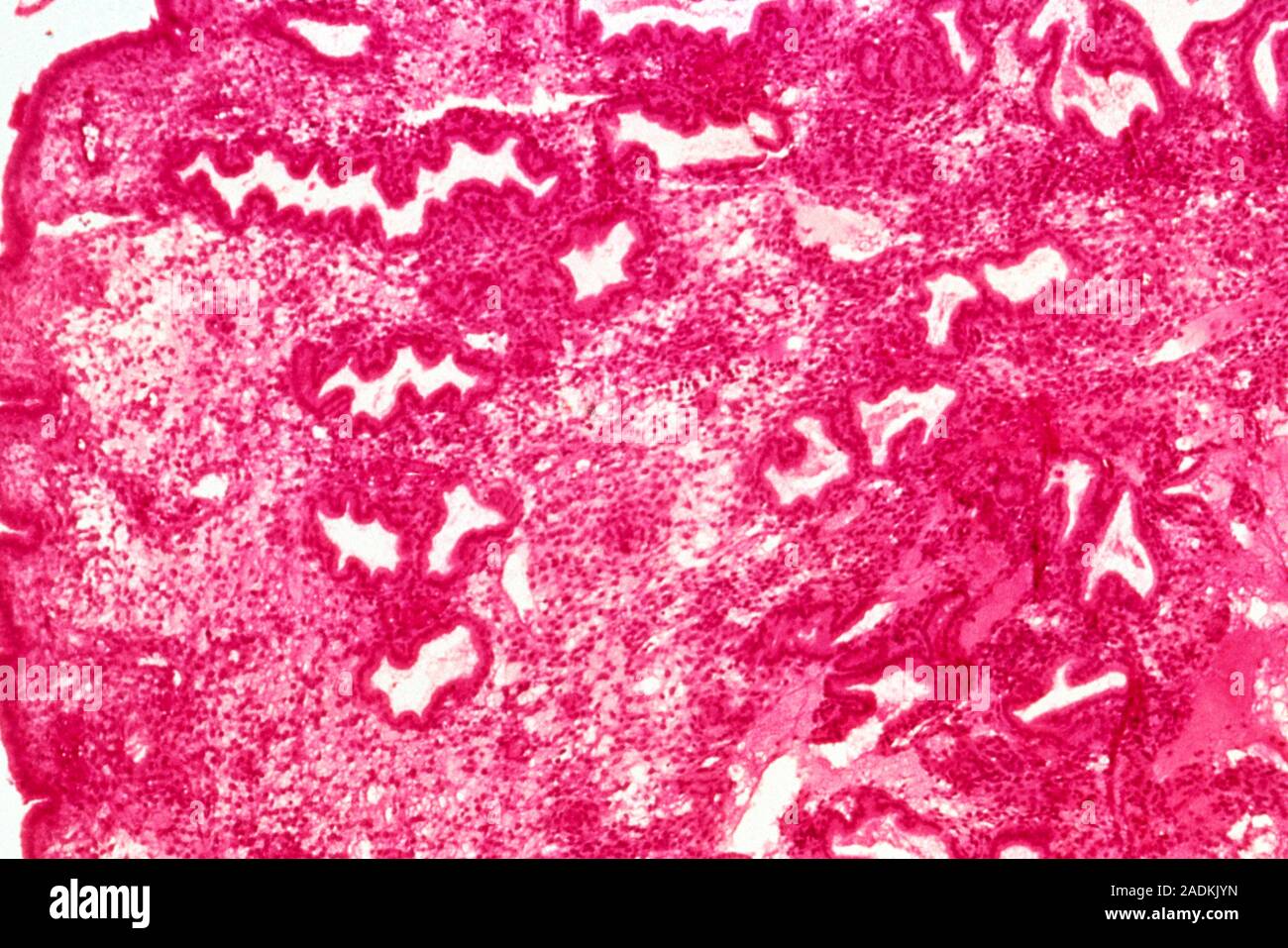 Light micrograph of a section of the endometrium, the mucosal lining of ...