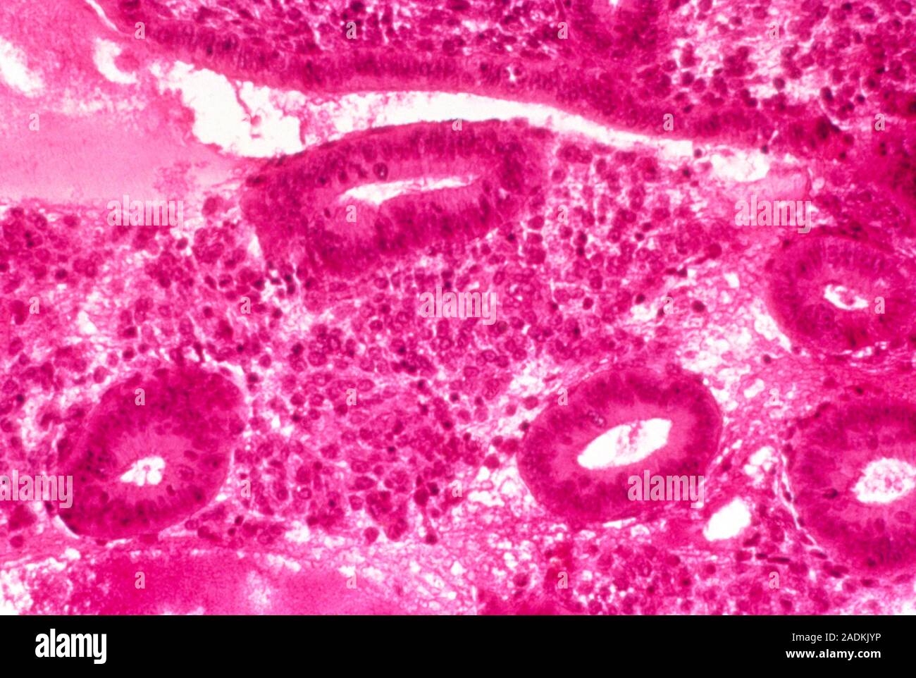 Light micrograph of a section of the endometrium, the mucosal lining of ...