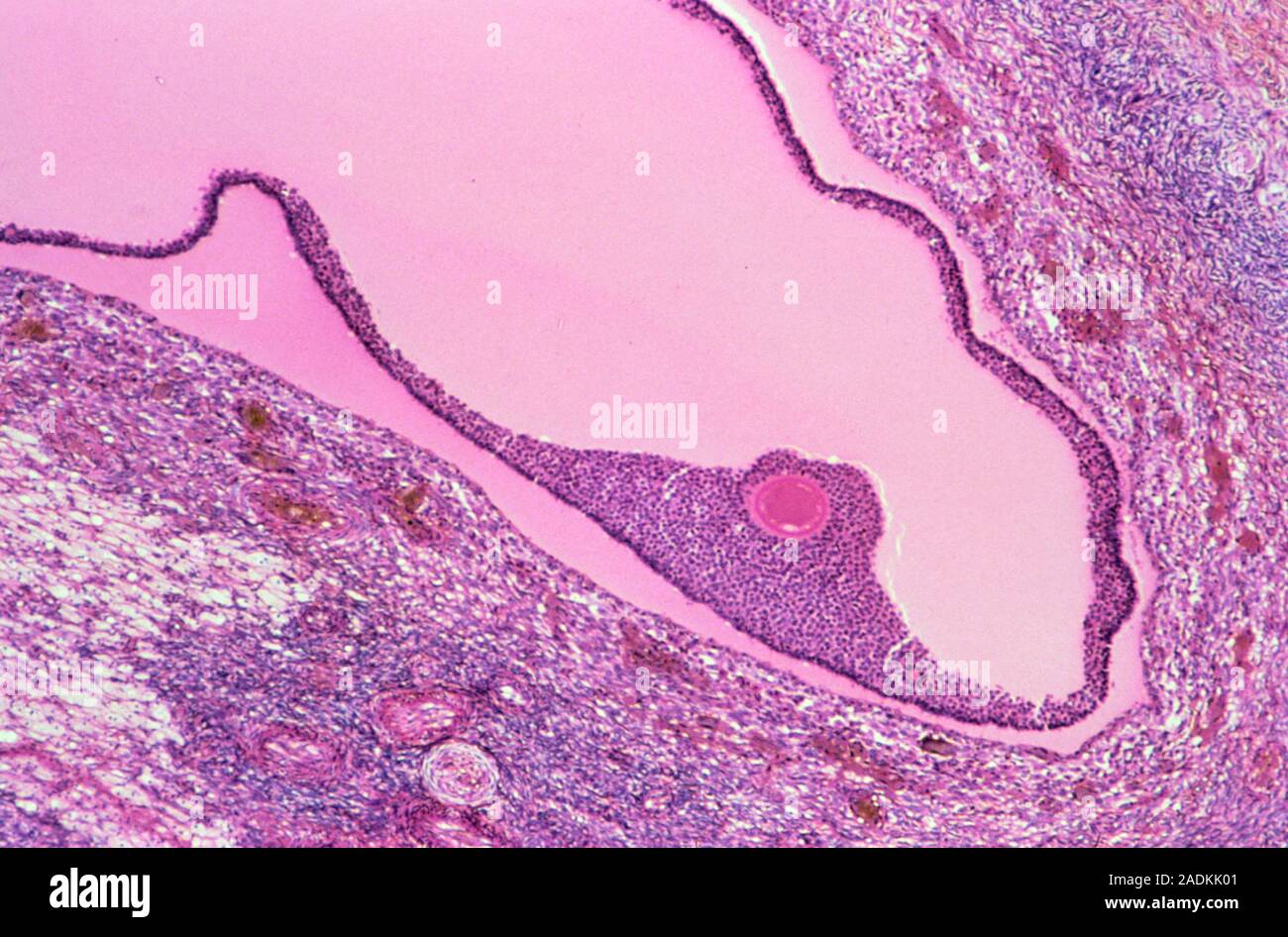 Light micrograph of a mature, human ovarian (graafian) follicle ...