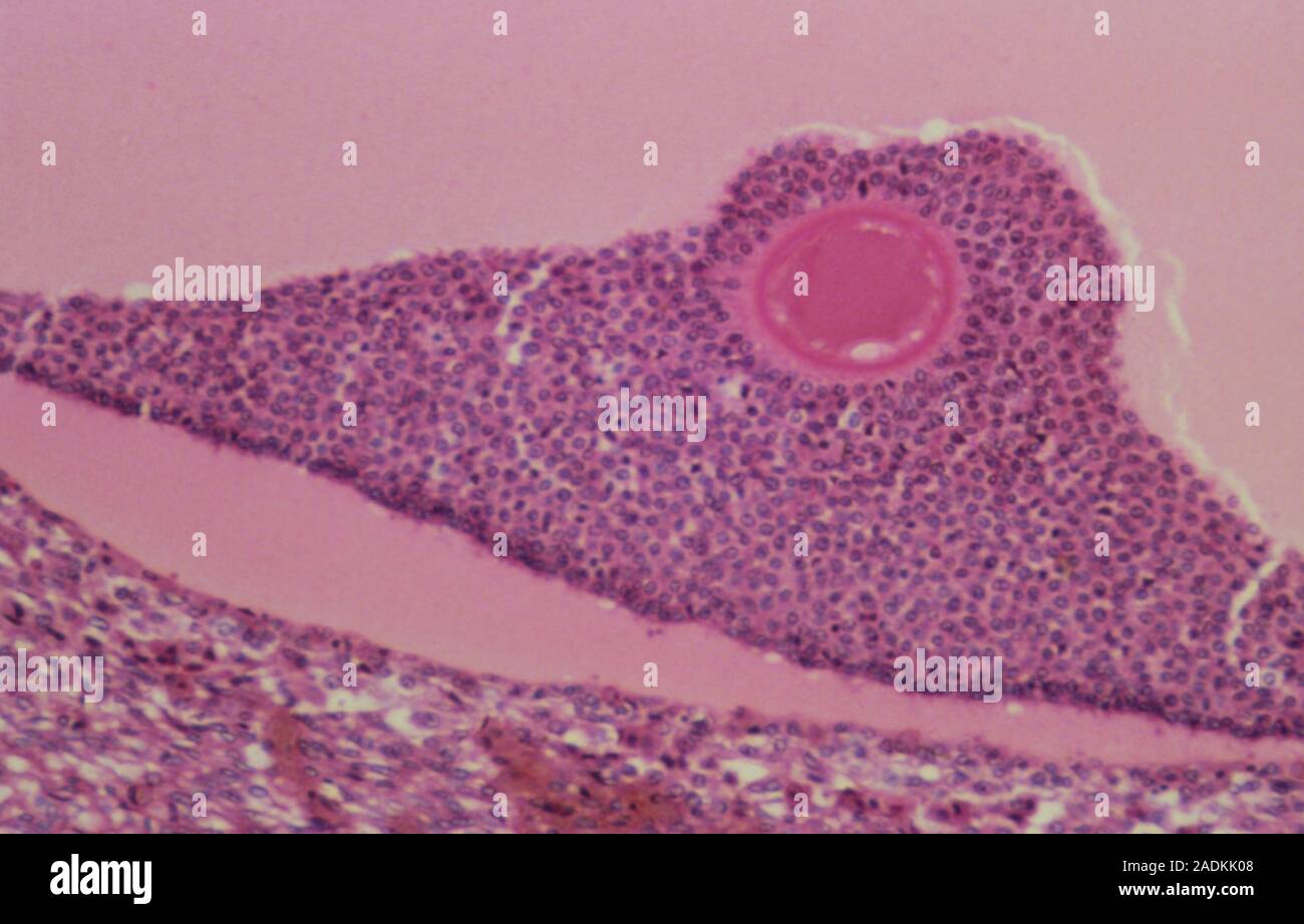 Light micrograph of normal human ovary, showing part of an active ...