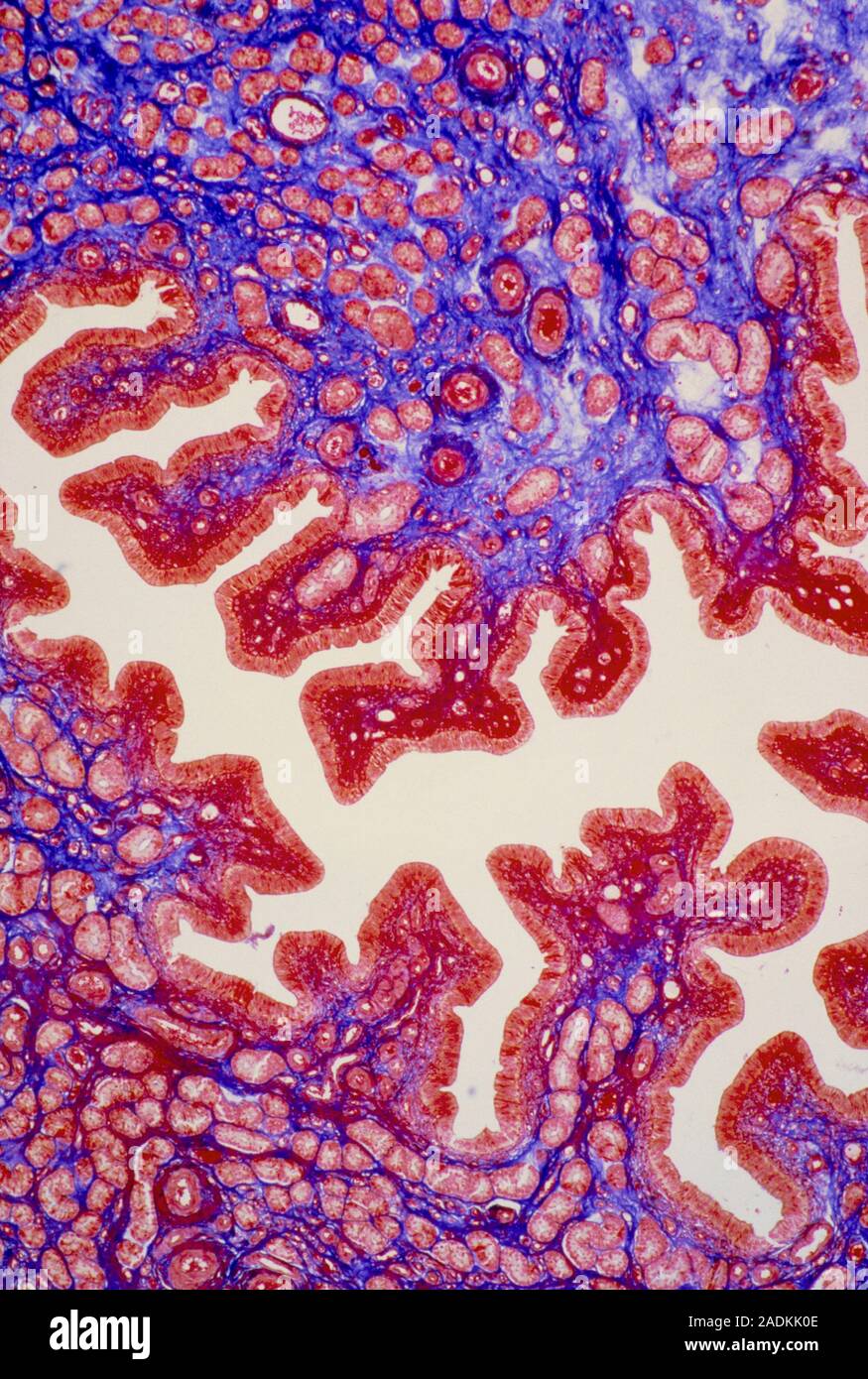 Light micrograph of a section through the wall of the uterus, showing ...