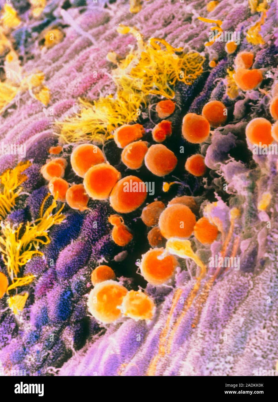 False-colour scanning electron micrograph (SEM) of the internal wall of ...