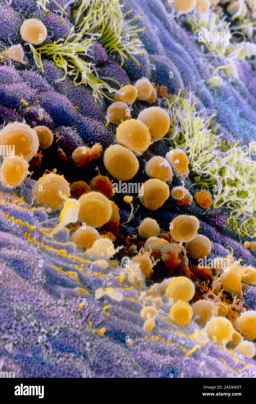False-colour scanning electron micrograph (SEM) of the internal wall of ...