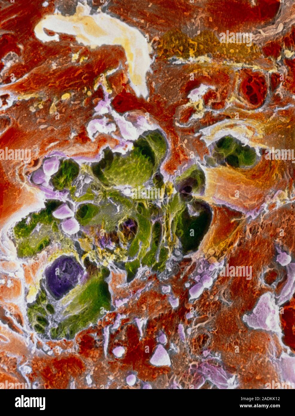 Ovary's site of ovulation. False-colour scanning electron micrograph of ...