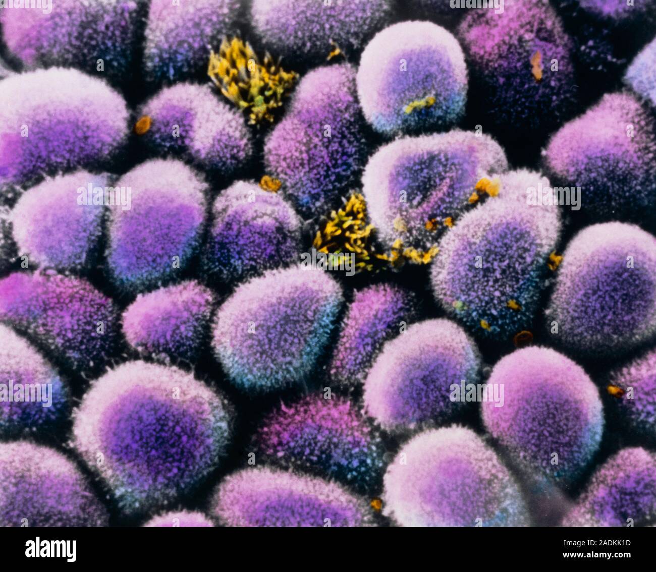 The internal wall of the uterus. Coloured scanning electron micrograph ...